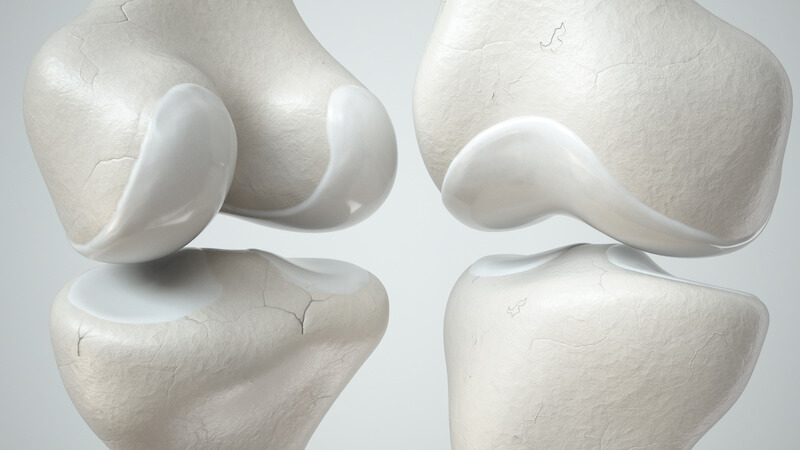 Try These Foods Good For Joints And Cartilage (And Avoid These Others ...